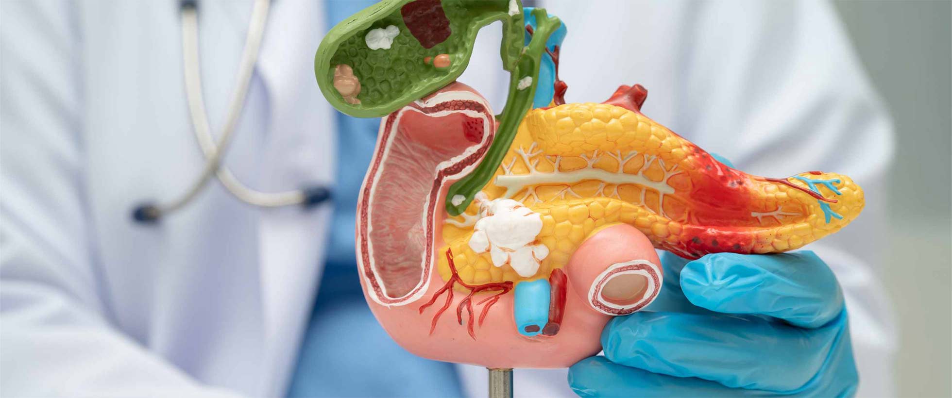 Understanding Pancreatitis: Causes, Symptoms, and When to Seek Help ...